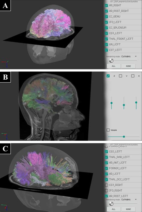 Example Of Brain Data Visualization Of A Healthy Subject Consisting Of