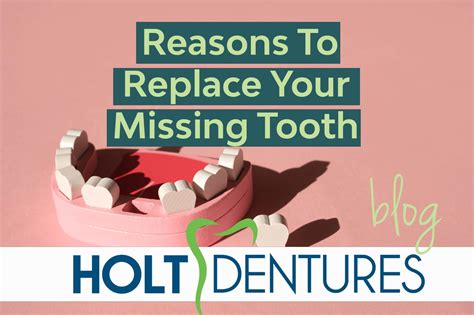 Why Missing Tooth Replacement Is More Important Than You Think