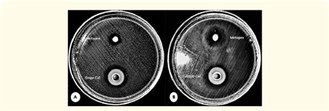 Antimicrobial Susceptibility Test By Disc Diffusion Method And The Download Scientific Diagram