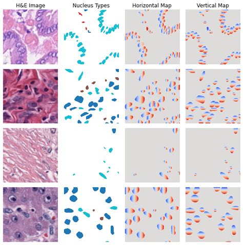 Machine Learning Training A Hover Net Model — Pathml 300 Documentation