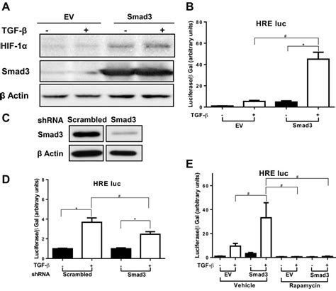 Tgf β Smad3 Activates Mammalian Target Of Rapamycin Complex 1 To Promote Collagen Production By