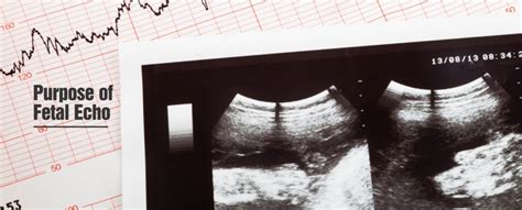 Fetal Echocardiography Purpose Procedure Risks Fetal ECHO Test Price In Chandigarh