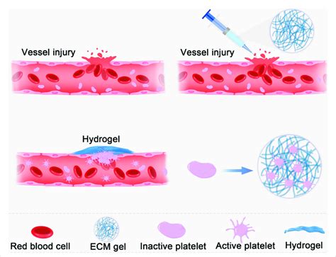 Schematic Diagram Of The Use Of Ecm Hydrogel Showed Irregular Fibrous Download Scientific