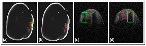 J Imaging Free Full Text Lesion Detection In Optical Coherence