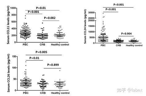 Labex多因子平台，助力原发性胆汁性胆管炎（pbc）研究 知乎