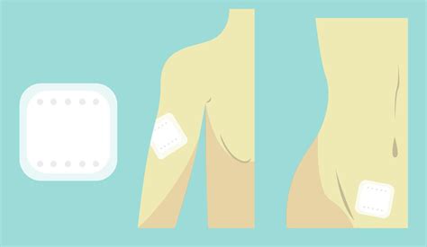 Contraceptive Patch Flat Vector Illustration 5490787 Vector Art At Vecteezy