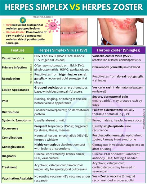 Medinaz Herpes Simplex Vs Herpes Zoster Facebook