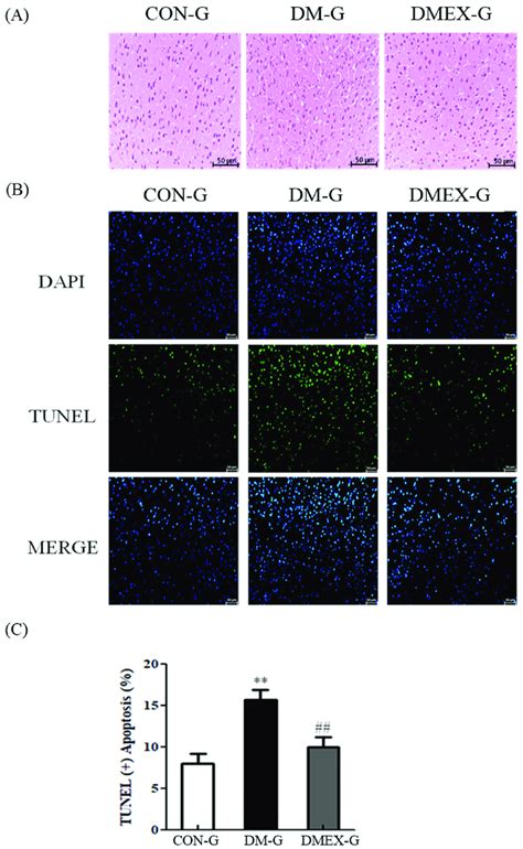 A Sections Of Cerebral Cortex Were Stained With Hematoxylin And Eosin Download Scientific