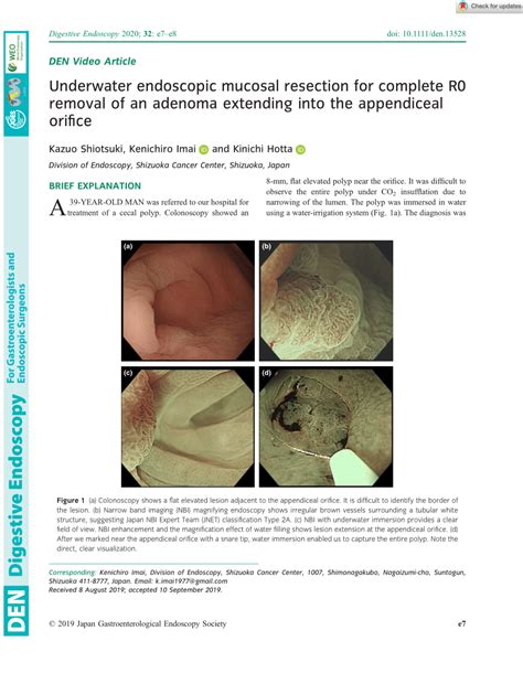 Guidelines Endoscopic Mucosal Resection At Jose Mccoy Blog