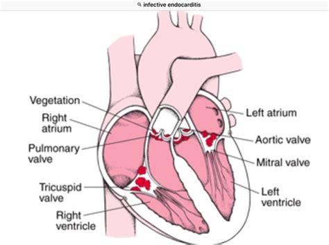 ECHO Flashcards Quizlet