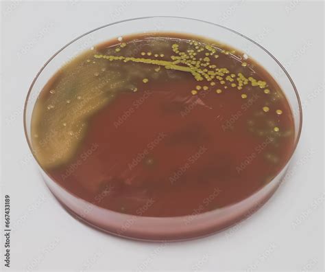 Foto De Golden Color Colonies On Chocolate Agar Medium Growth Of Staphylococcus Aureus Gram
