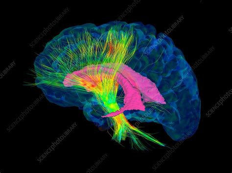 Brain Fibres Dti Mri Scan Stock Image C017 7036 Science Photo Library