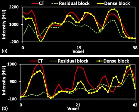 Mri‐only Based Synthetic Ct Generation Using Dense Cycle Consistent Generative Adversarial