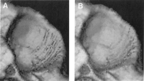 Detail Of The Rendered Acetabula Of Fig 3 Download Scientific Diagram