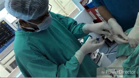 Ijv Cannulation Pt 2 Youtube