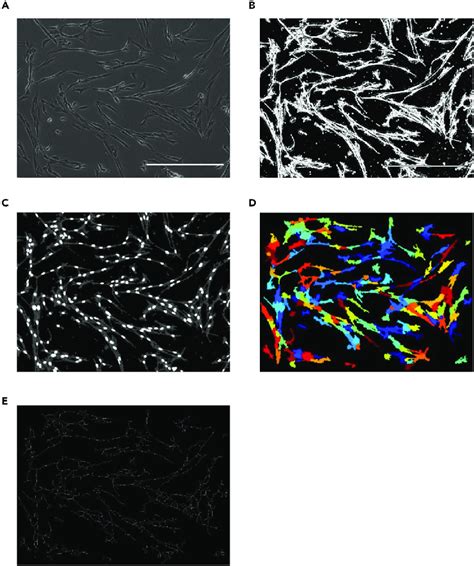 Processing Stages Of The Morphology Quantification Pipeline Using Download Scientific Diagram