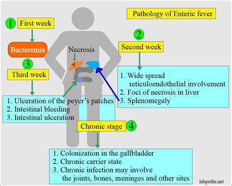Enteric Fever Part 2 Typhoid Enteric Fever Diagnosis Widal Test Its Procedure And
