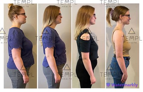 Doctor Supervised Weight Loss Program TEMPL Health