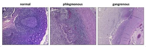 Histopathological Features Of The Vermiform Appendix 40 A Normal