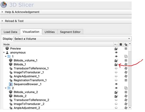 custom visualization behavior on clicking eye icon support 3d slicer community