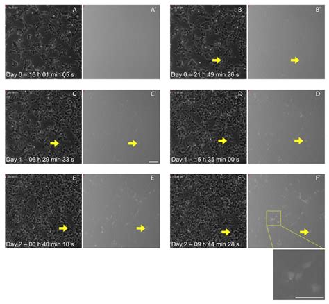 Live Imaging Of Primary Cerebral Cortex Cells Using A 2d Culture System