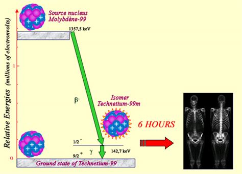 Technetium Uses In Medicine Techne® Mdp Injection Pre Filled Syringe