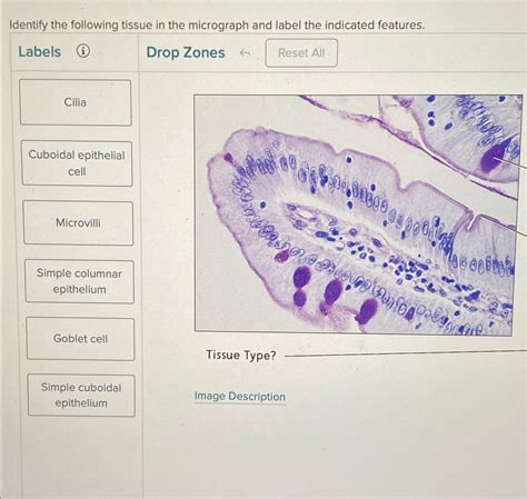 Solved Identify The Following Tissue In The Micrograph And