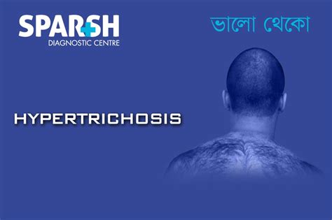 Hypertrichosis Causes Symptoms Diagnosis And Treatment Sparsh Diagnostic Center