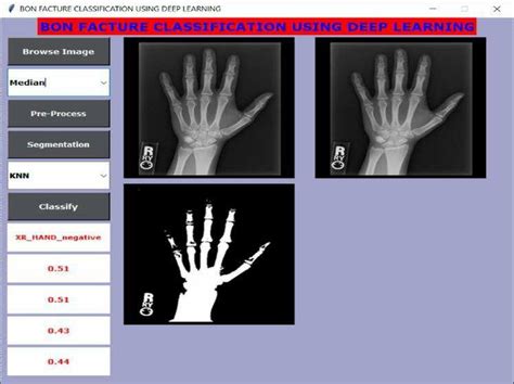 Knn Classifier As Show In Figure When Svm Classifier Is Applied The Download Scientific Diagram