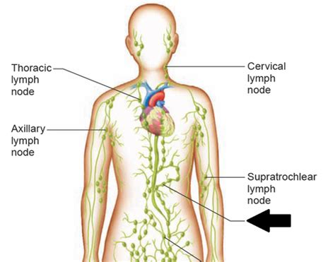 Supratrochlear Lymph Nodes