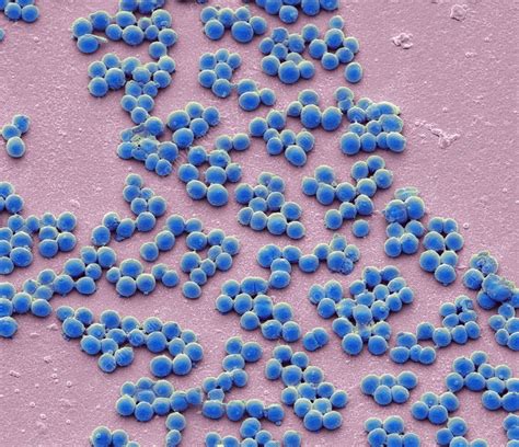 Group A Streptococcus Bacteria Sem Stock Image C057 3770 Science Photo Library