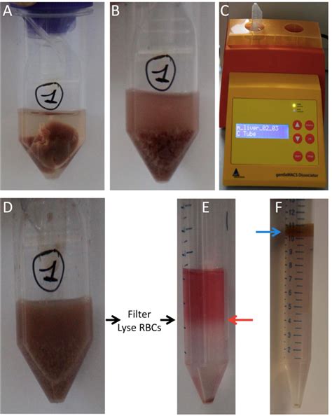 Murine Liver Myeloid Cell Isolation Protocol —bio Protocol