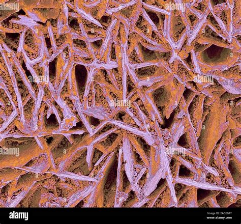 Rust Coloured Scanning Electron Micrograph Sem Of Rust On An Iron