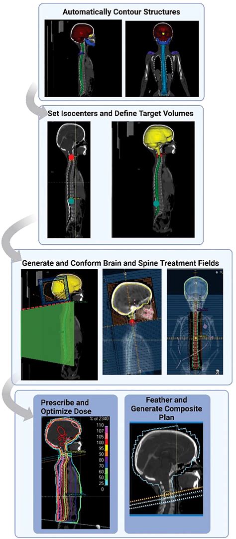 Figure 1 From Validation Of An Automated Contouring And Treatment Planning Tool For Pediatric