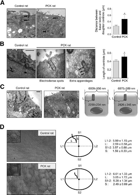 Centrosomal Abnormalities In Cystic Cholangiocytes A Representative Download Scientific