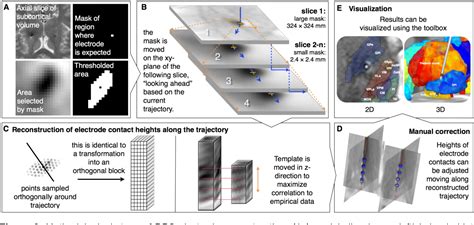 Figure 2 From Lead Dbs A Toolbox For Deep Brain Stimulation Electrode Localizations And