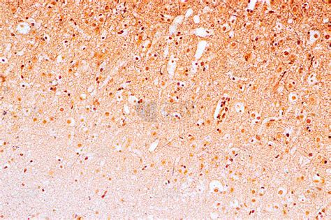 教育脊髓，神经，小脑，皮质和运动神经元人在实验室显微镜下。