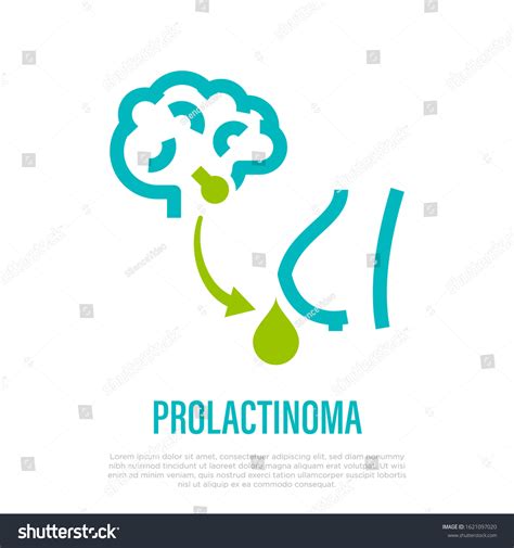 Prolactinoma Over 36 Royalty Free Licensable Stock Vectors And Vector