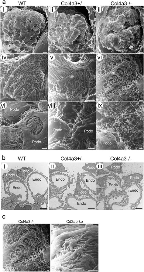 Glomerular And Podocyte Morphology In Wild Type And Col4a3 Mutant Mice Download Scientific