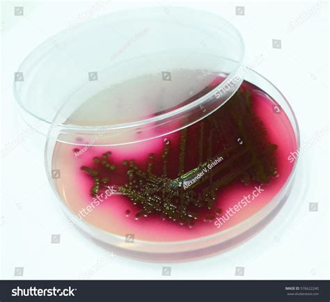 Agar Plate E Coli Escherichia Coli Image And Photo Free Trial