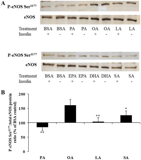 A A Typical Western Blot Analysis Of Phosphorylated Enos Ser¹¹⁷⁷ And