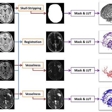 Schematic Overview Of Our Processing Pipeline Download Scientific Diagram