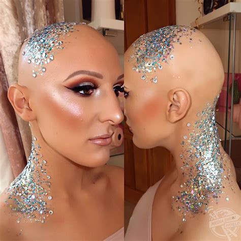 Bald Is The New Beautiful According To The Stunning Mother Who Wants To Unite Her Alopecia And