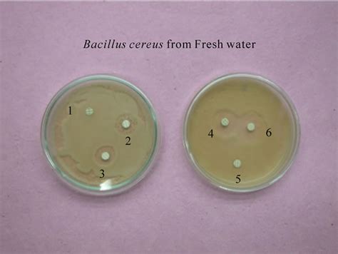 Bacillus Cereus Nutrient Agar