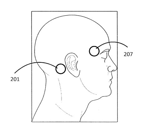 Apparatuses And Methods For Transdermal Electrical Stimulation Of Nerves To Modify Or Induce A