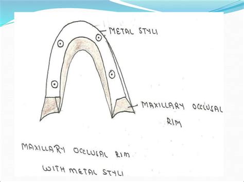 Centric Jaw Relation By Dr Rajanikanth Av Ppt