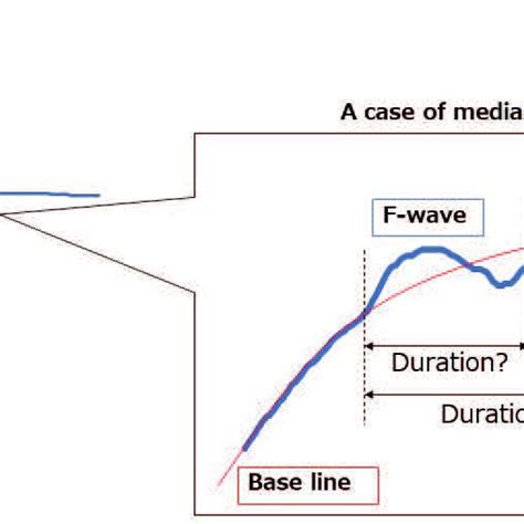 A Way To Measure Amplitude Value Download Scientific Diagram