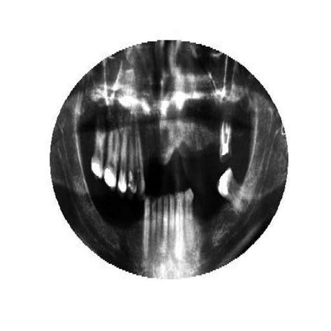 My First Projectbalance Data Object Detection Dataset And Pre Trained Model By Balance Data