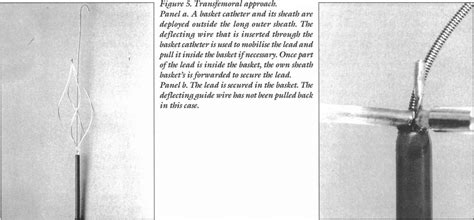 Transfemoral Approach Download Scientific Diagram