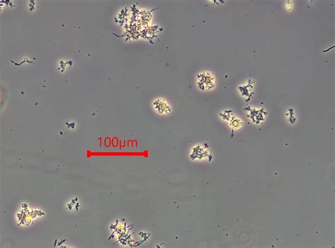 Bug Of The Month Distinguishing The Causes Treatment Plant Operator